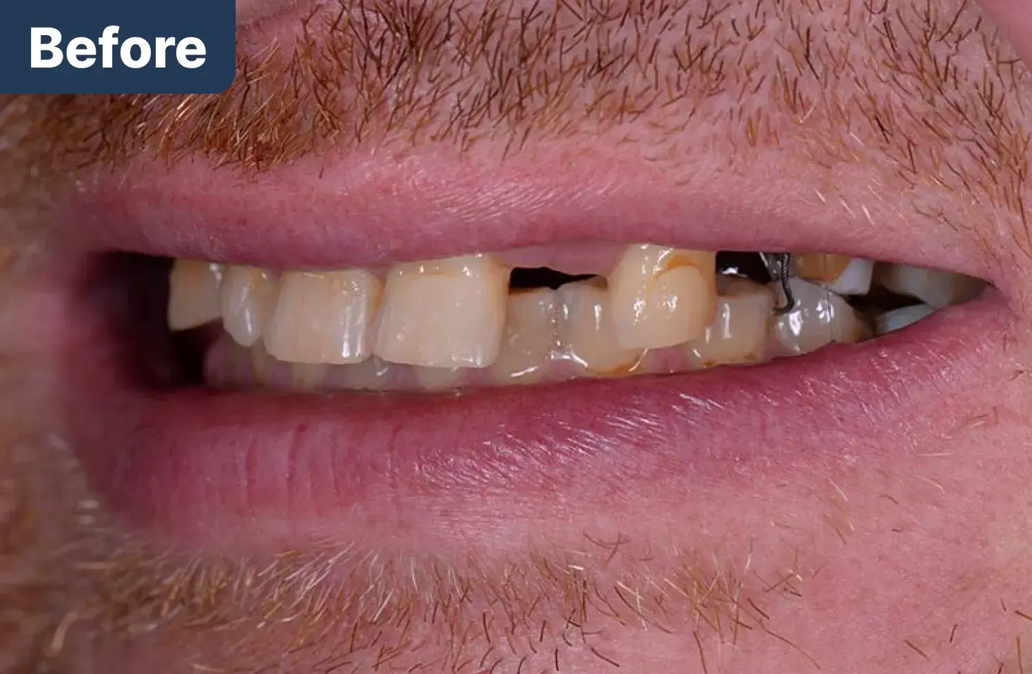 Before and After Dental Gallery | Dynamic Dental Design, Covina