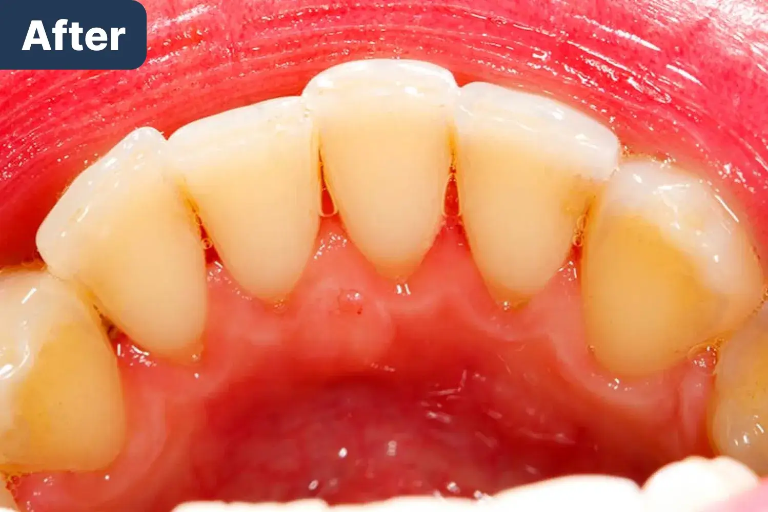 Before and After Dental Gallery | Dynamic Dental Design, Covina