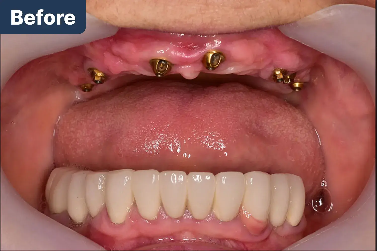 Before and After Dental Gallery | Dynamic Dental Design, Covina