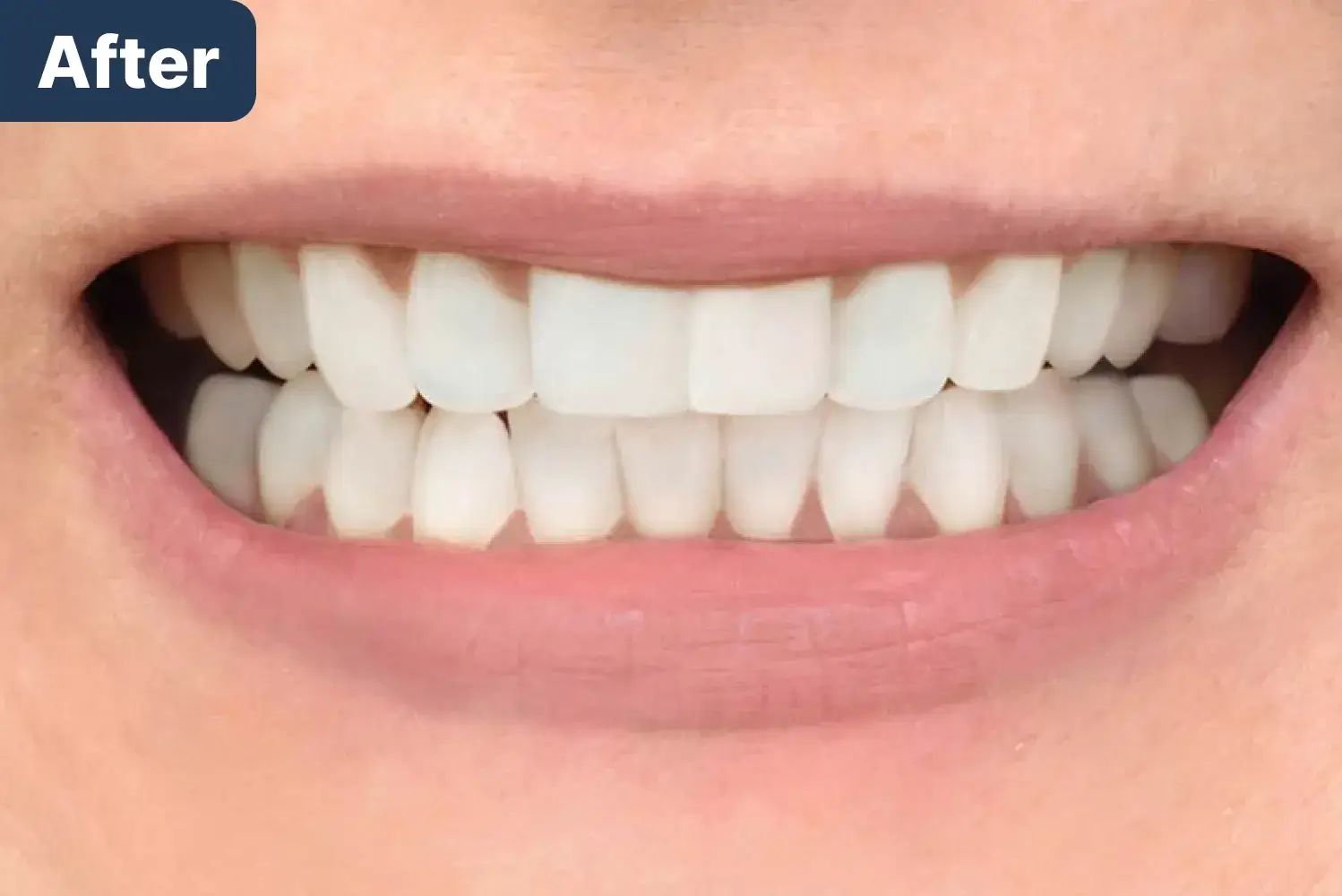 Before and After Dental Gallery | Dynamic Dental Design, Covina