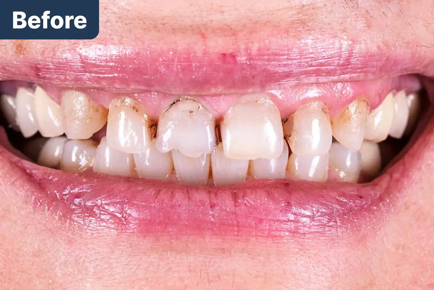 Before and After Dental Gallery | Dynamic Dental Design, Covina