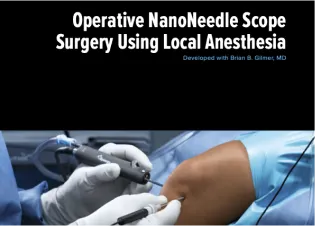 The Nano Arthroscopy Experience