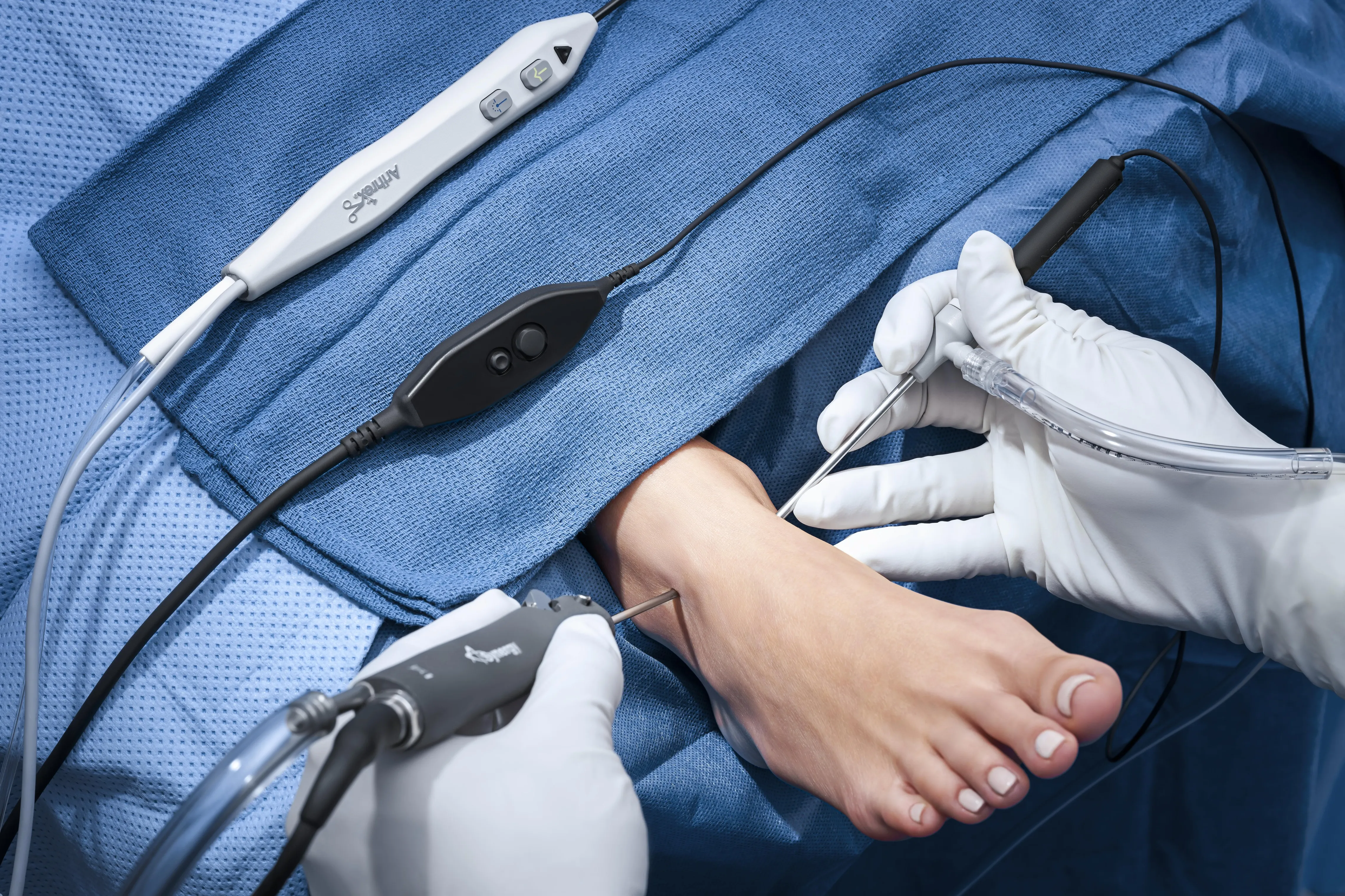 The Nano Arthroscopy Experience