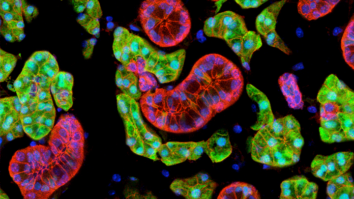 Sjögren’s Team for Accelerating Medicines Partnership (STAMP)