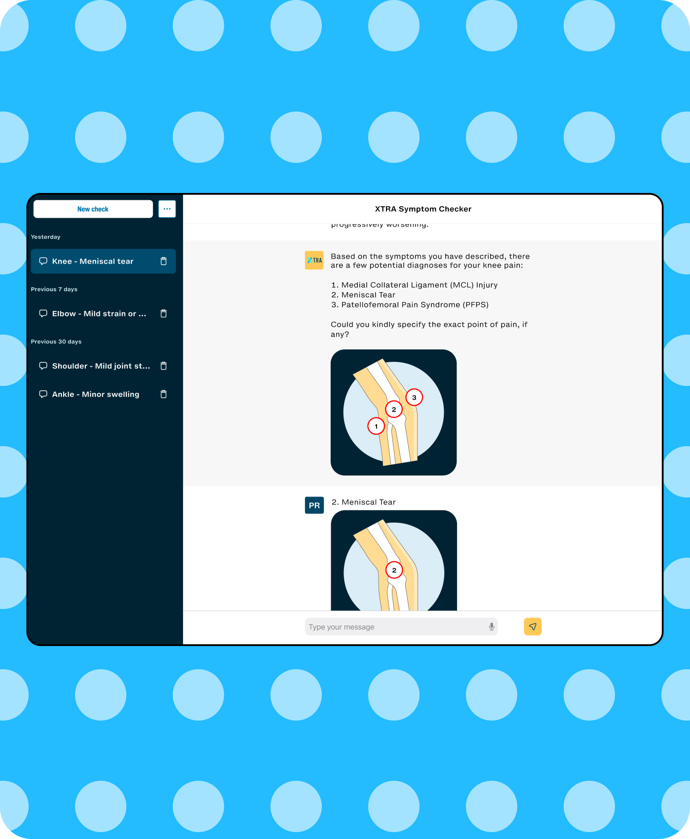 XTRA - 3D Motion APIs for Digital MSK, Health and Wellness App