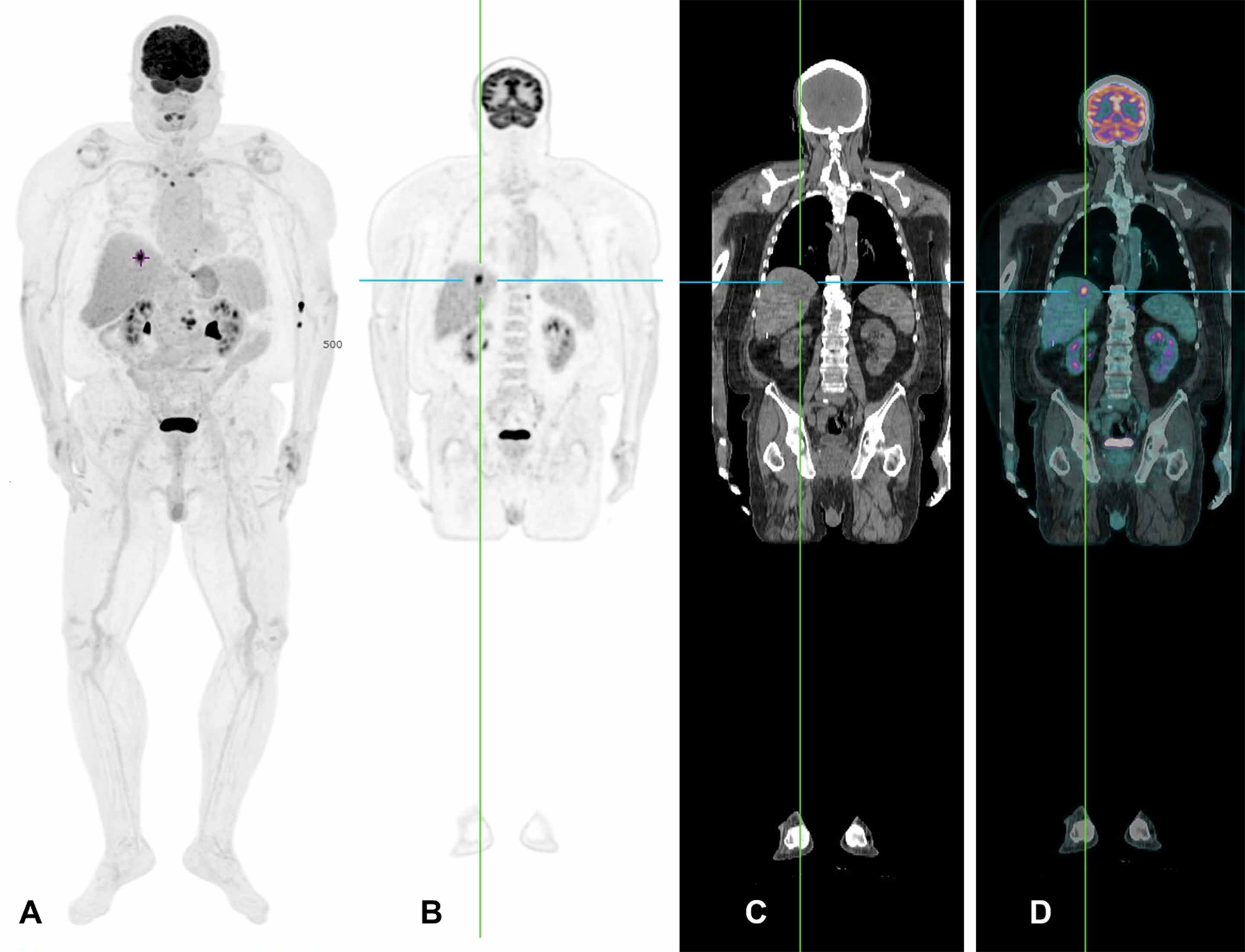 MSU brings better cancer diagnosis and treatment home to Michigan