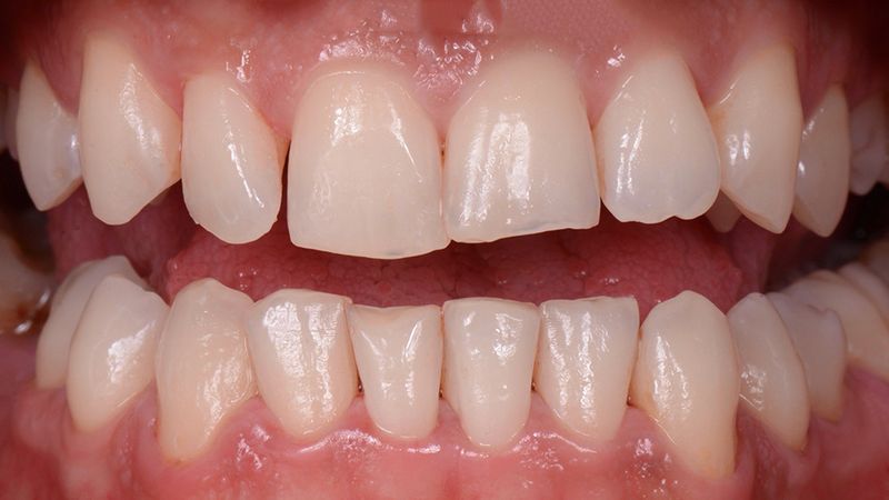 Switch to GBT | Oral Wellness Starts Here | Find a GBT Practice Now