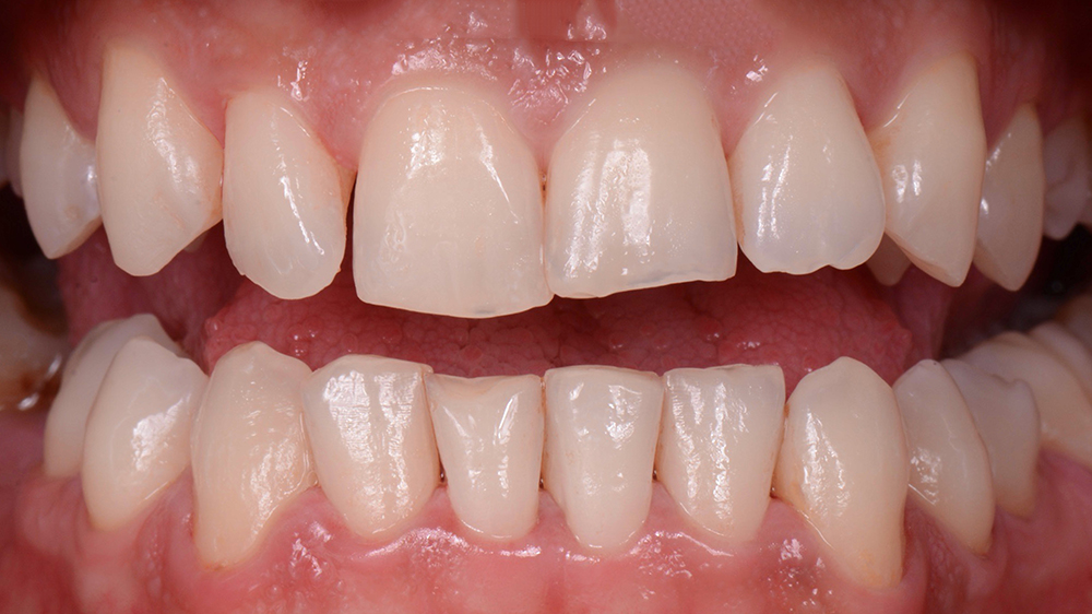 Switch to GBT | Oral Wellness Starts Here | Find a GBT Practice Now