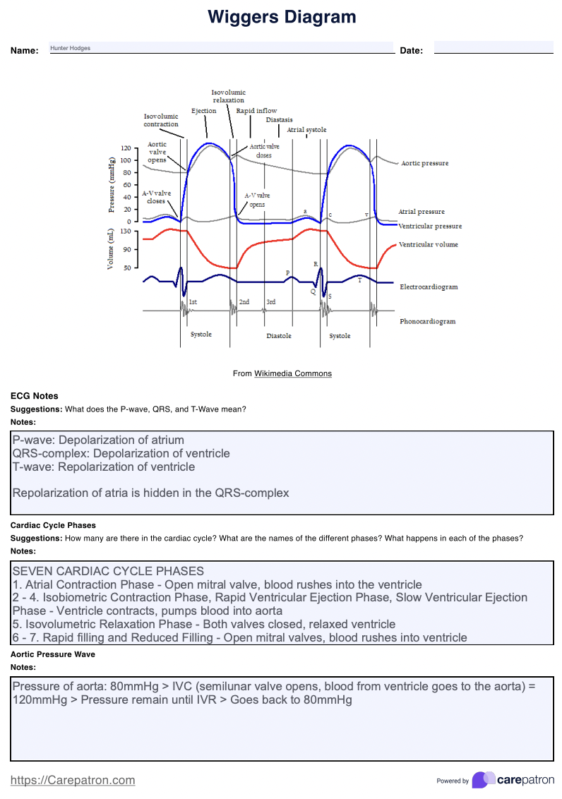 Wiggers Diagram Labeled