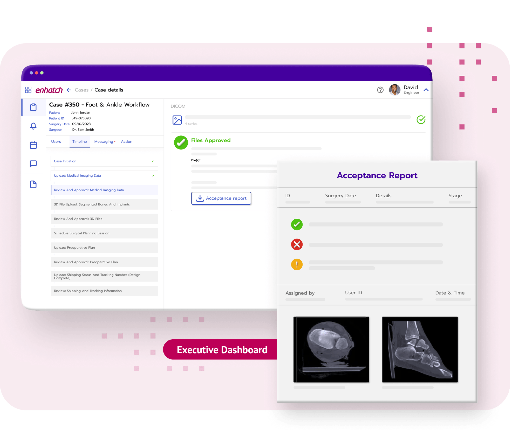Enhatch: 3D planning for 3D printed implants and surgical guides