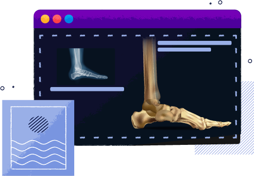 Enhatch makes 3D planning simple | Virtual Surgical Planning