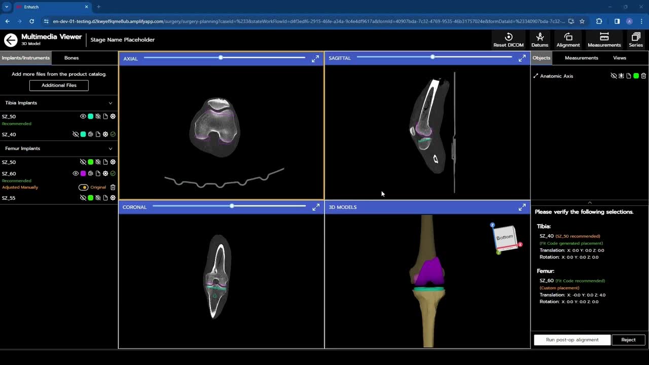 Enhatch makes 3D planning simple | Virtual Surgical Planning
