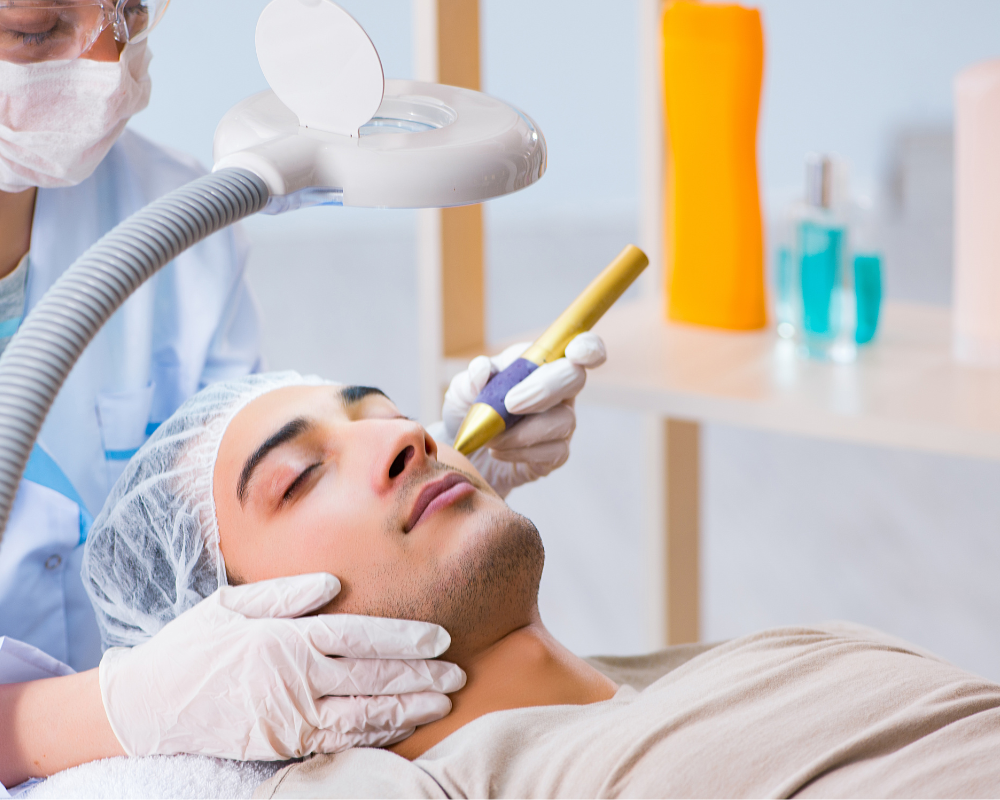 Acne Scars Removal | Treatment