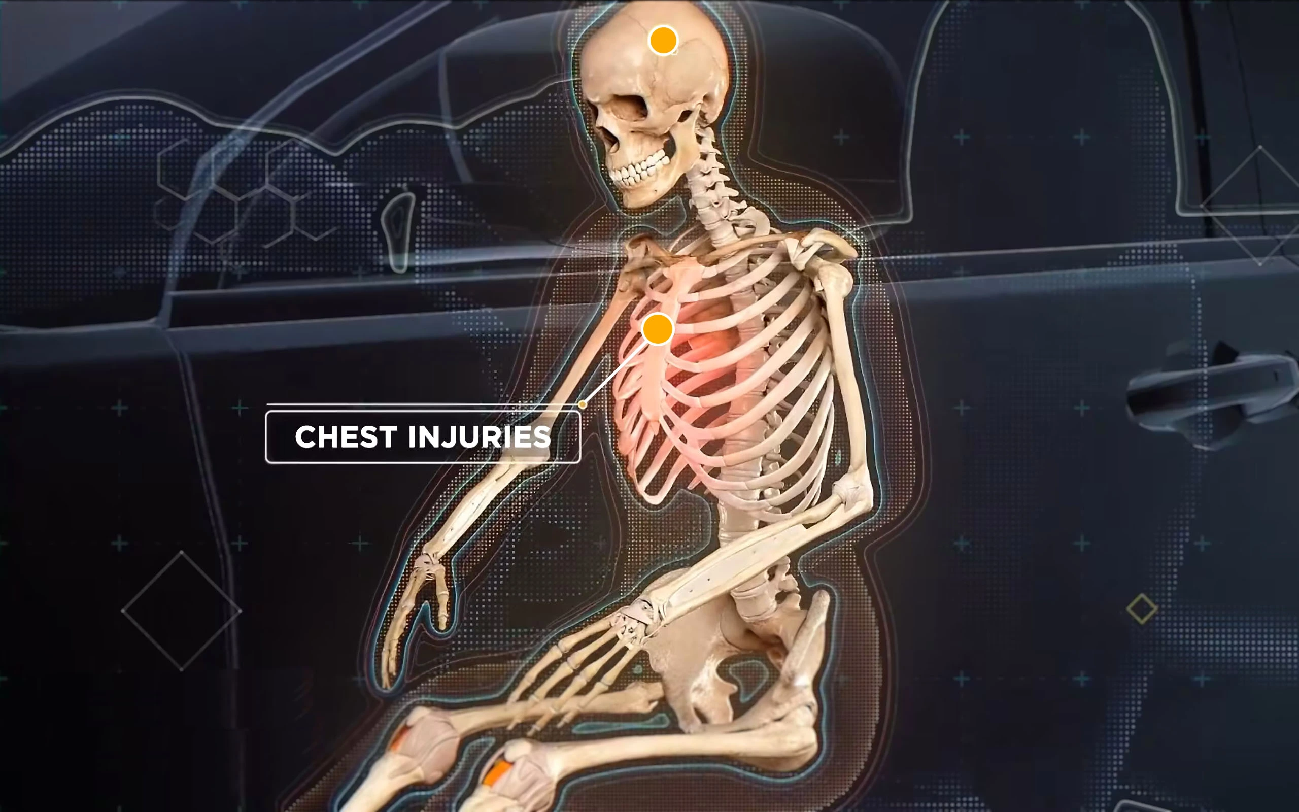 Portfolio | Intervoke