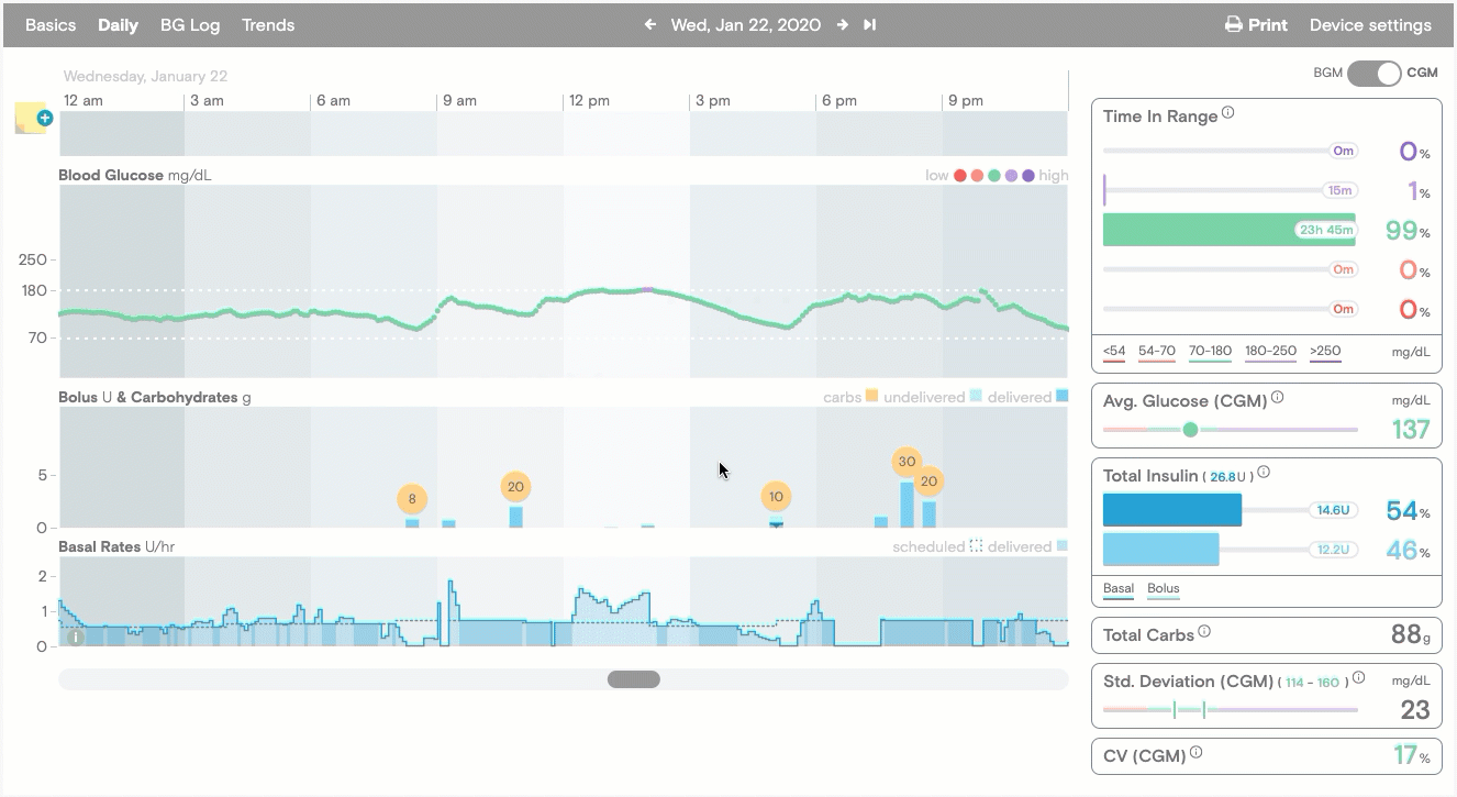 Tandem Control-IQ™️ technology and Tidepool | Tidepool