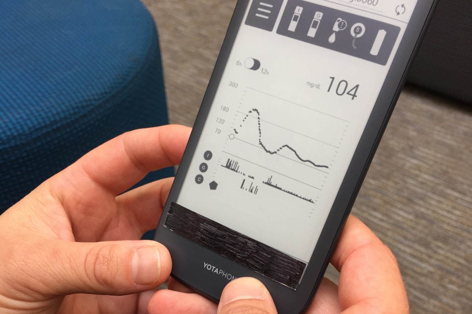 Bionic Pancreas user interface pt. 4 | Tidepool