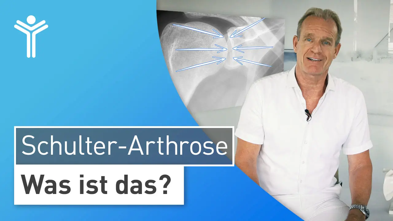Omarthrose | KLINIK am RING - Köln