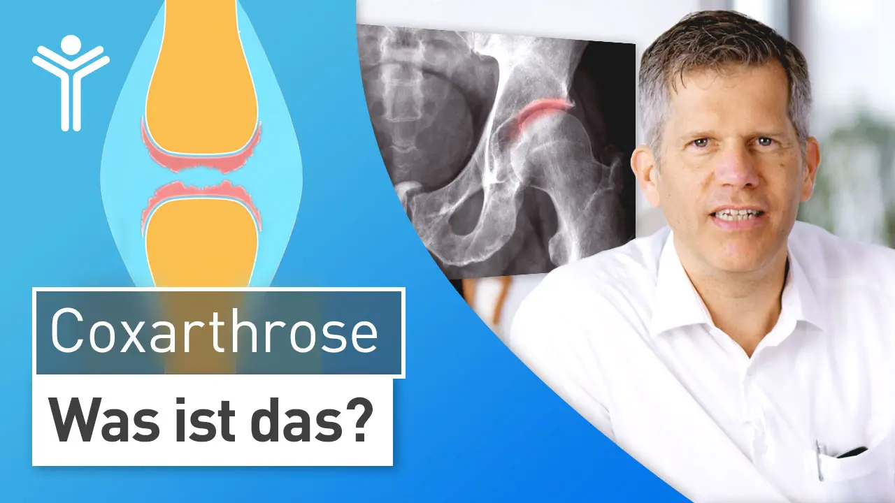 Coxarthrose | KLINIK am RING - Köln
