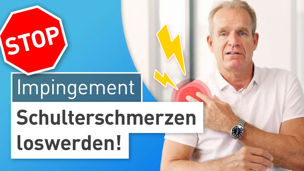Impingement Syndrom | KLINIK am RING - Köln