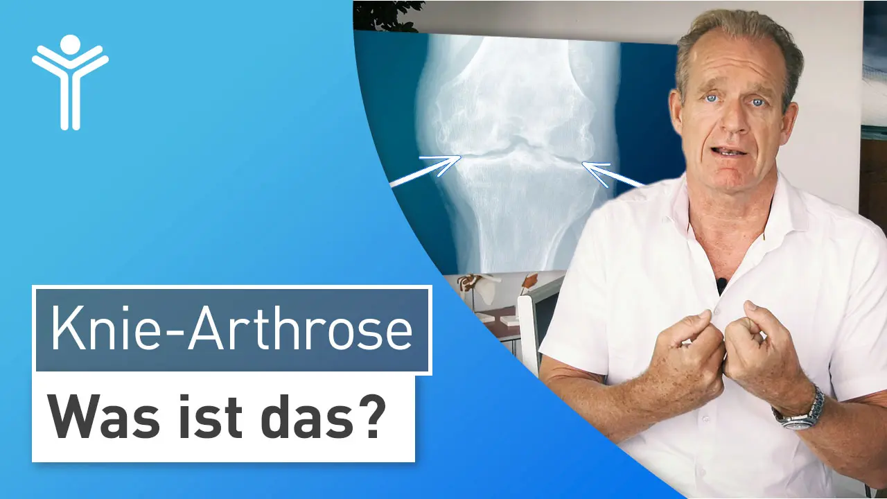 Gonarthrose | KLINIK am RING - Köln
