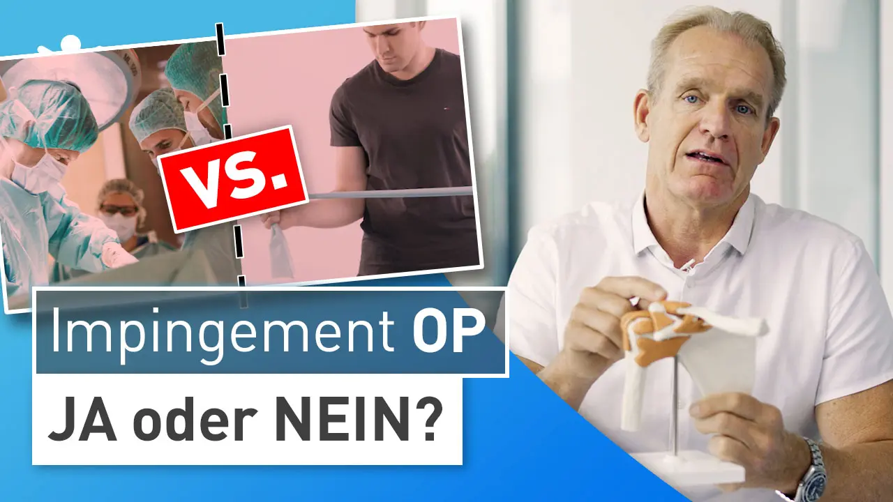 Impingement Syndrom | KLINIK am RING - Köln