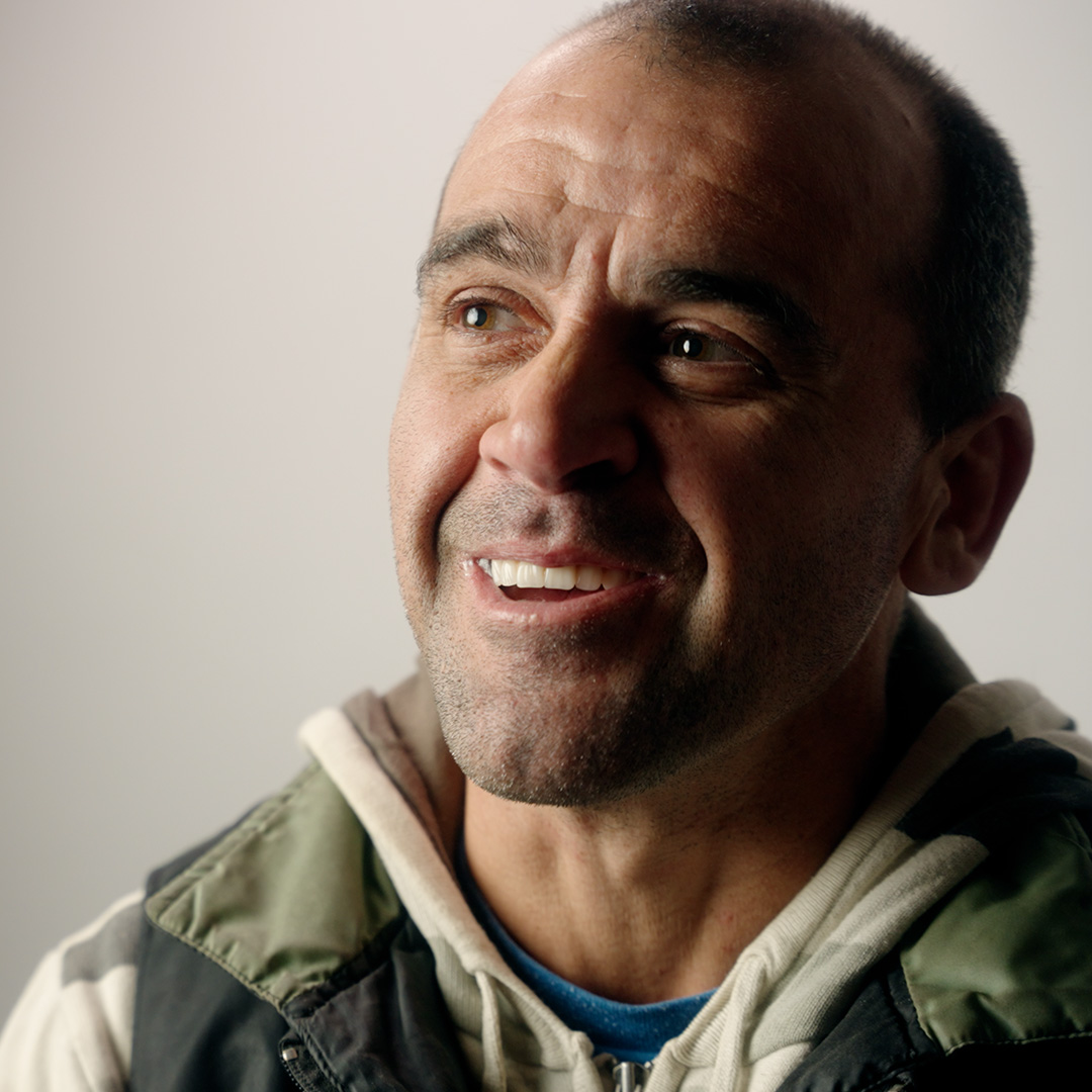 Tooth Replacement in Epping | Epping Dental Implant Centre