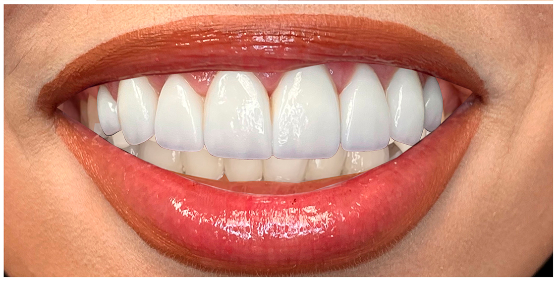 Orange County Cosmetic Dentist and Veneer Specialist : Transformative ...