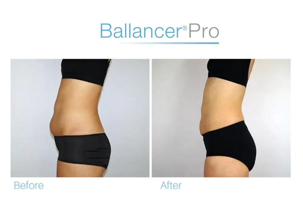 Ballancer® Pro Platinum