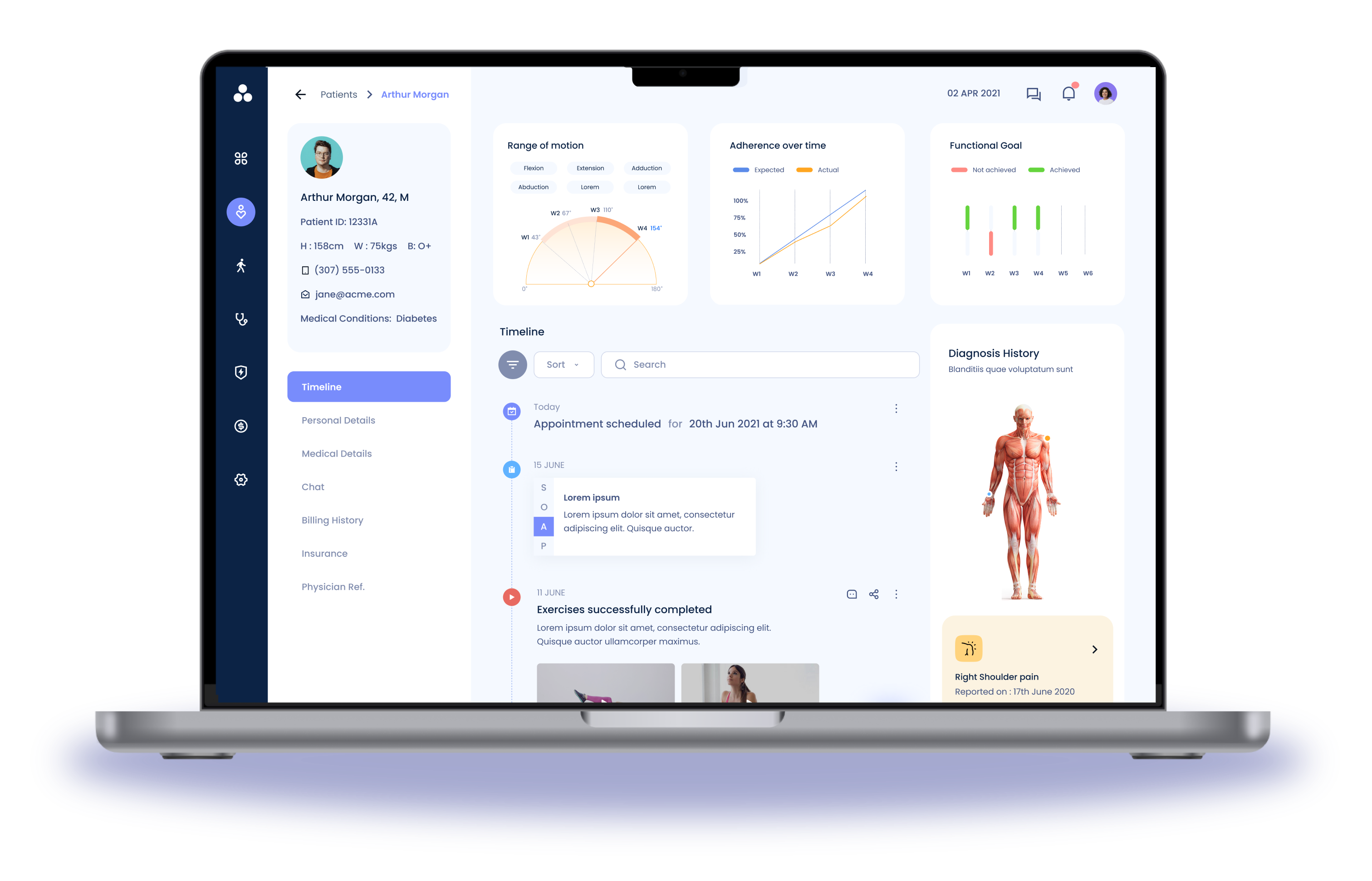 Transforming PT Clinics with Innovative Management Solutions | SPRY