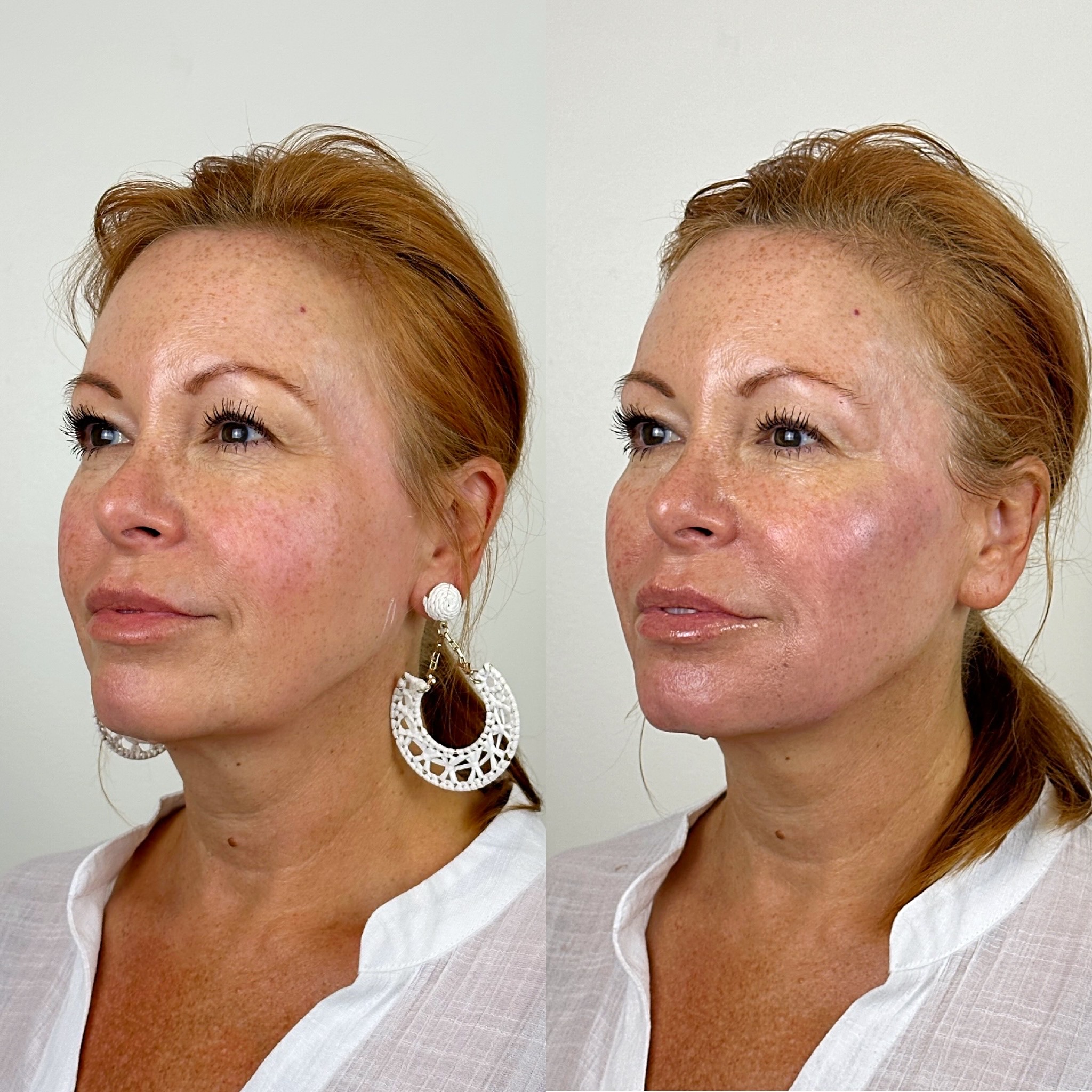 Our Beauty Services: Botox, Fillers, Facials & More | Park Aesthetics