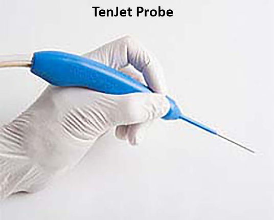 Achilles Tendonitis and Plantar Fasciitis | Gulf South Foot & Ankle