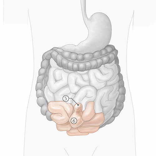 Score high on the NBME® Surgery Shelf exam with AMBOSS