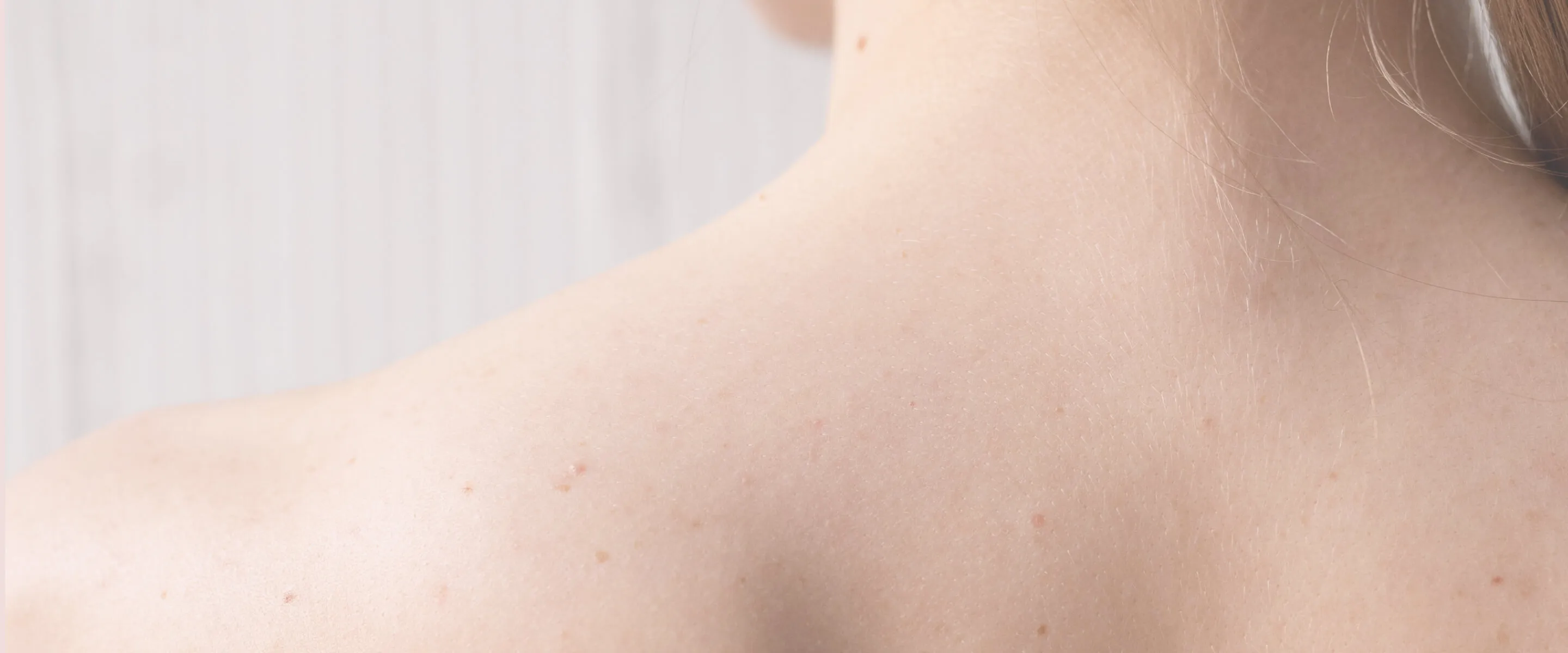 Medical and Cosmetic Dermatology in Charlottesville, VA | GABRIELLE ...