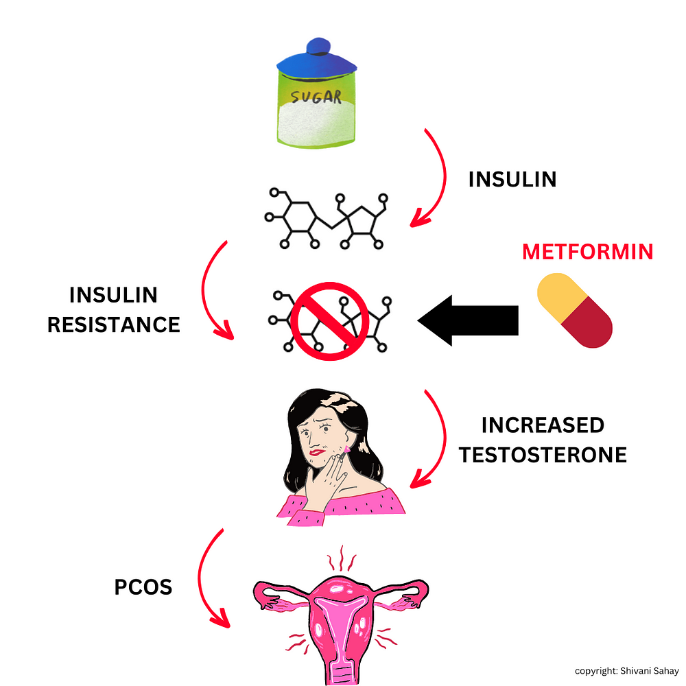 Metformin vs. Lifestyle Changes for PCOS: Which Is the Better Option?