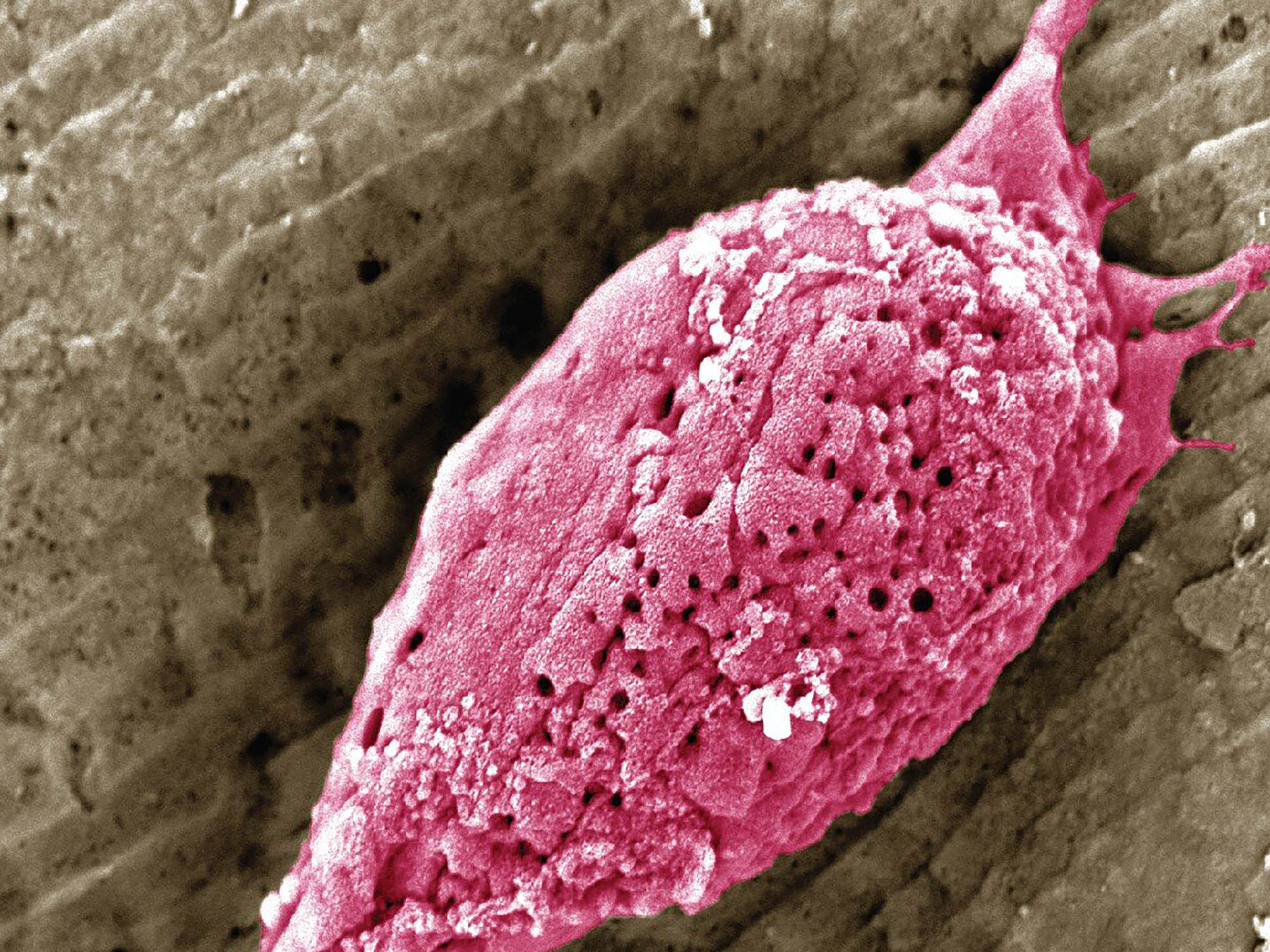 Team develops a non-allergenic wheat protein for growing better ...