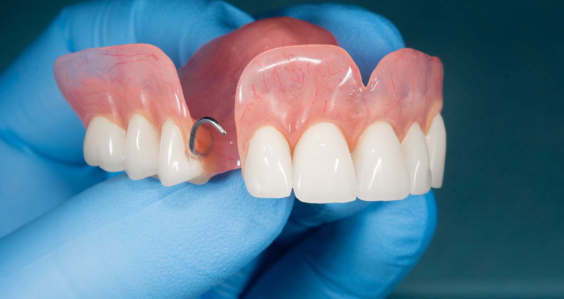 Dentures Columbia SC | Brickyard Dental Group