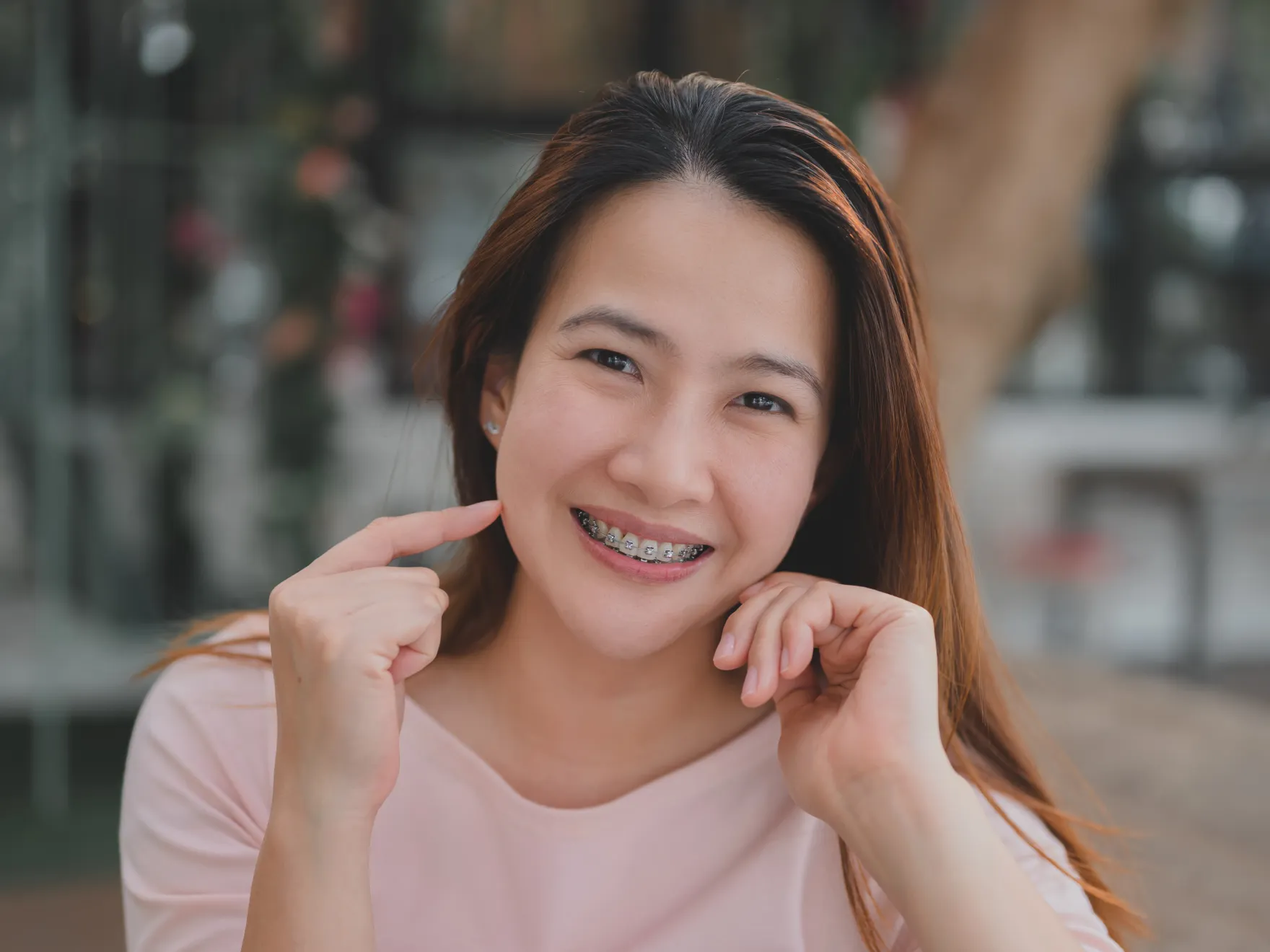 Straight, Beautiful Smiles with Orthodontics | Anytime Dental Gilbert