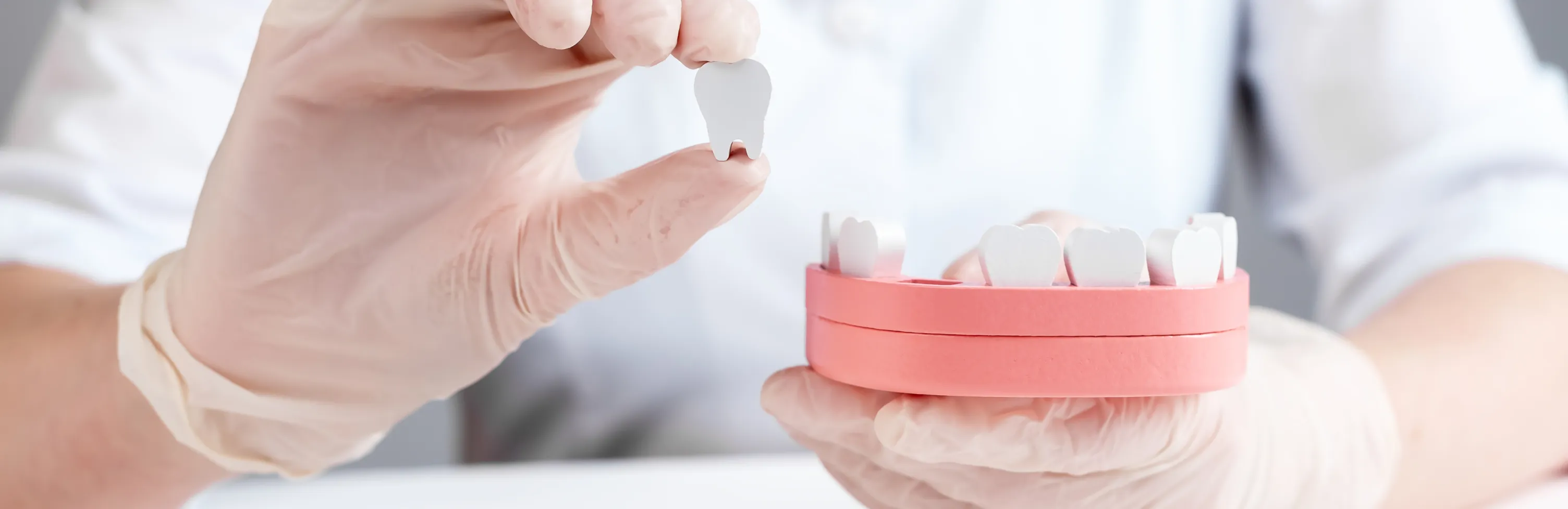 Options for Replacing Missing Teeth Options for Replacing Missing Teeth
