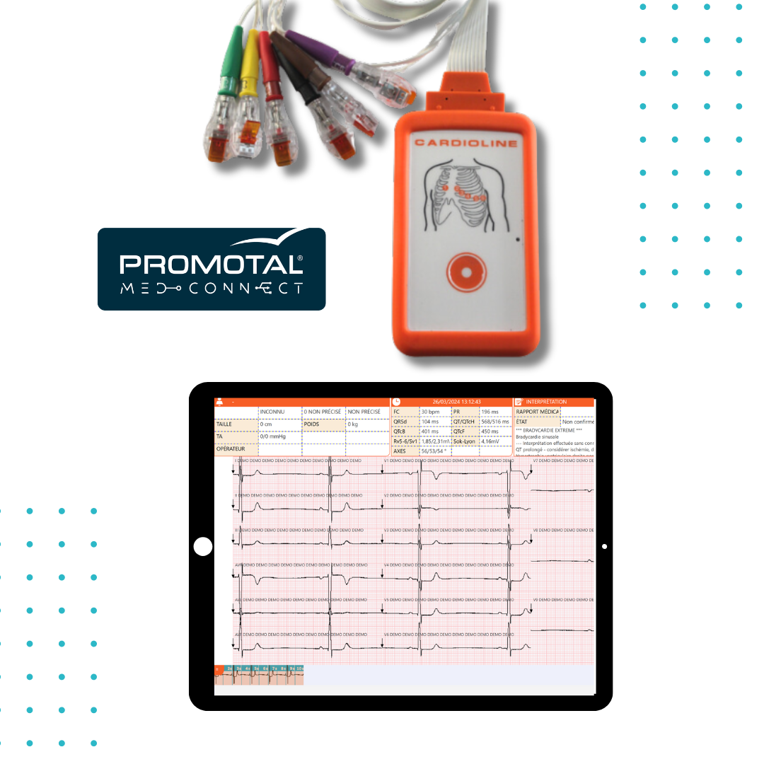 ECG Connecté Medconnect