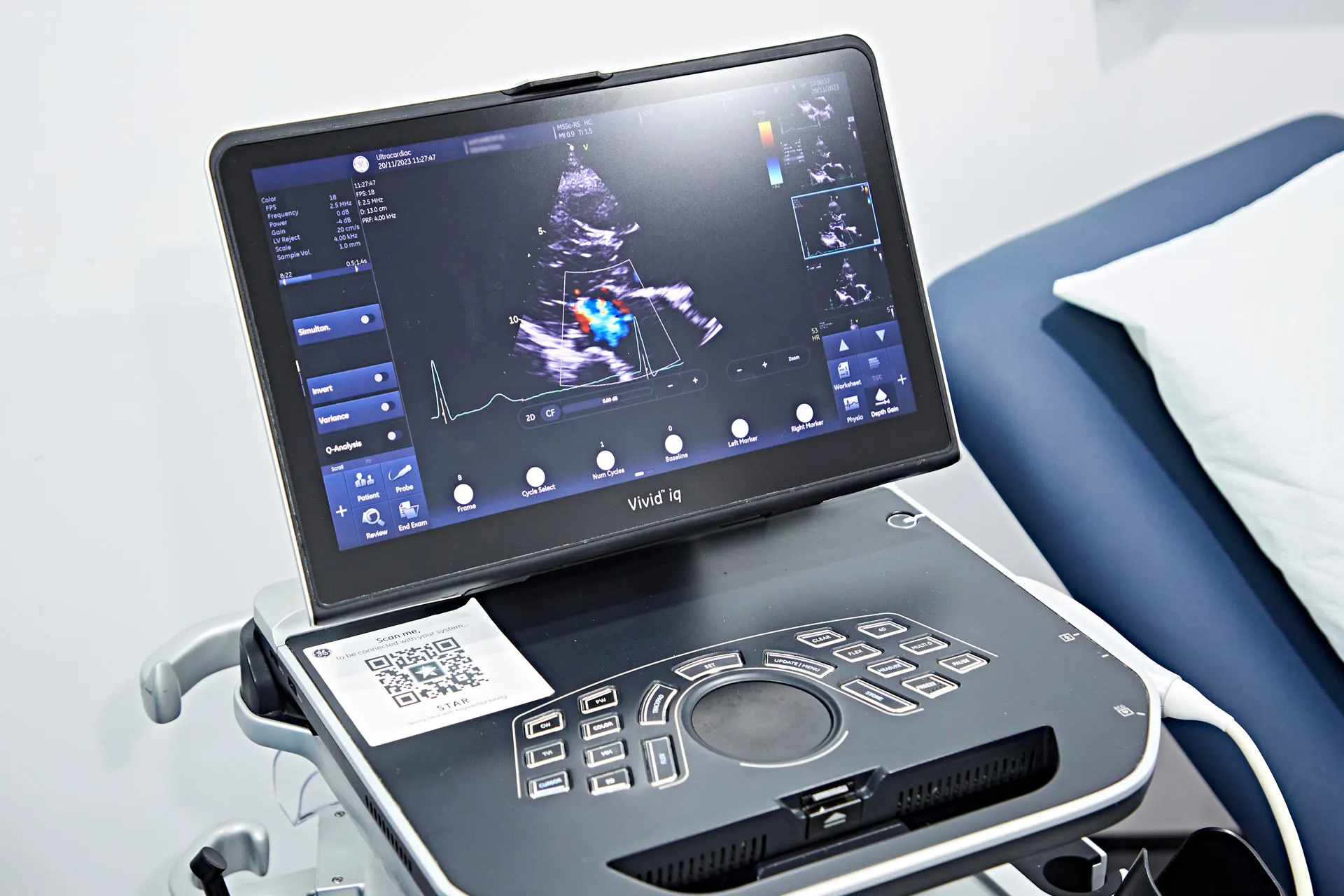 Ultracardiac | Echocardiography | Heart Ultrasound Scans