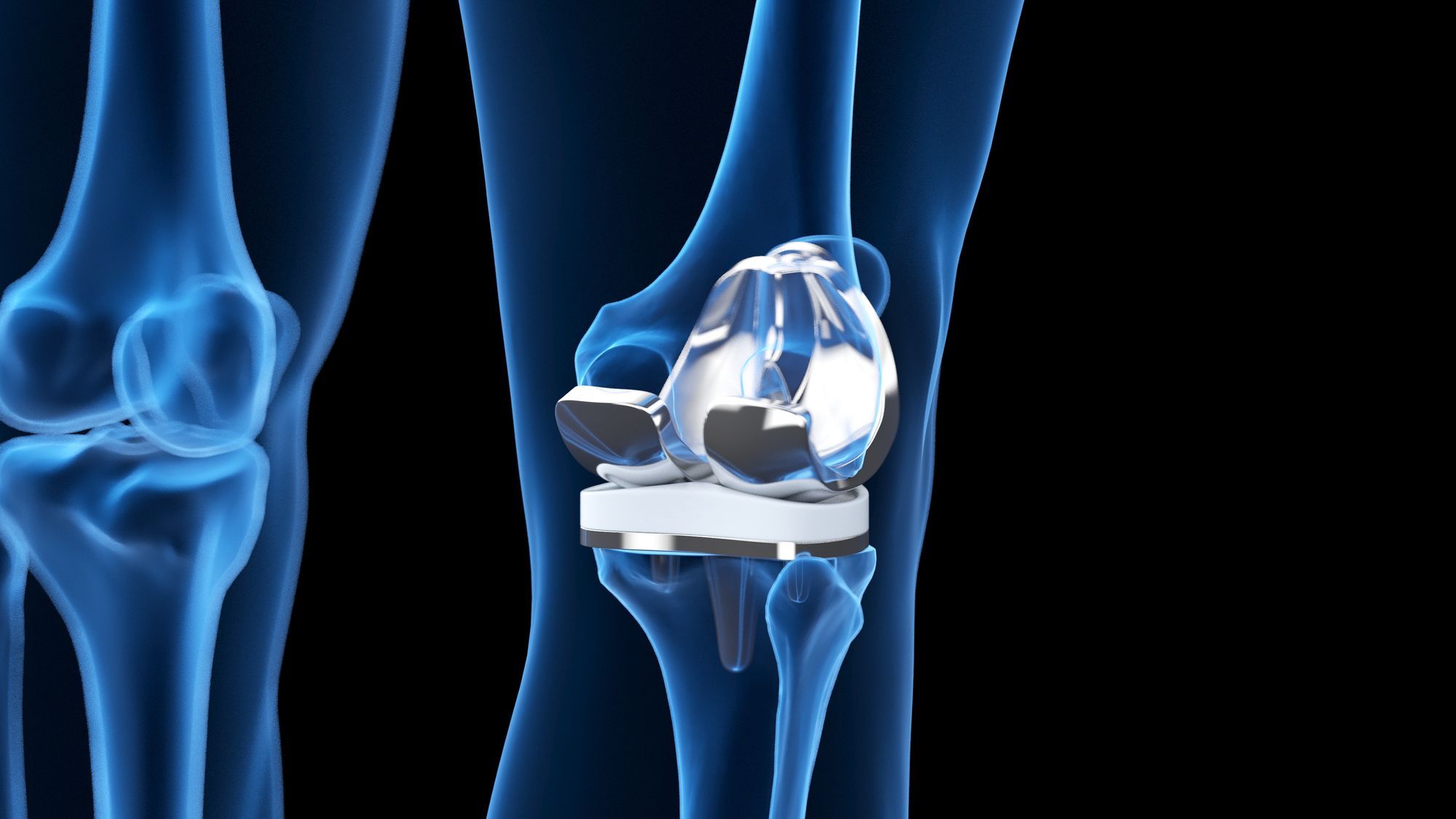 Knee Operative Treatments