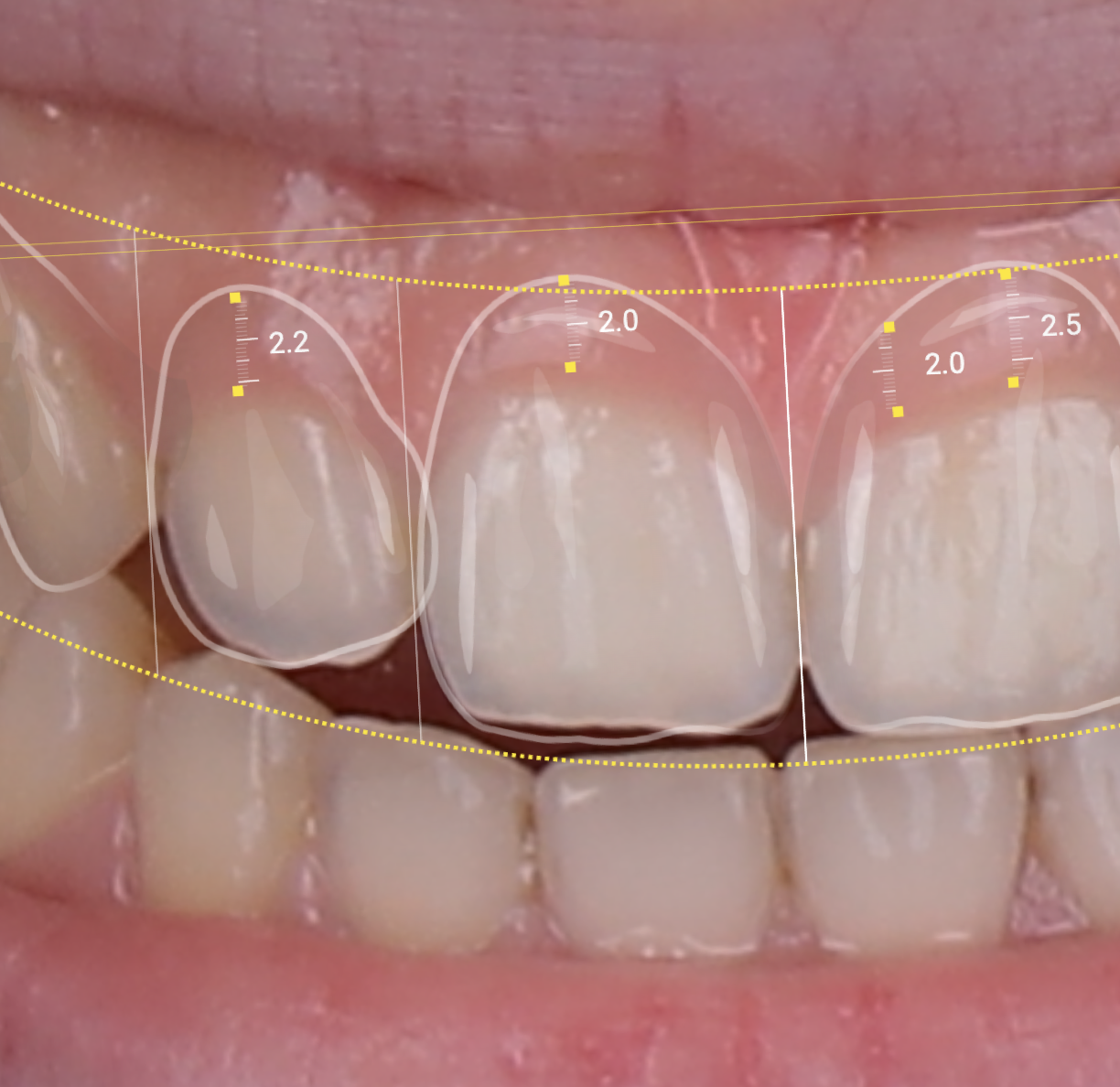 Metalab - Outsource Dental Designs