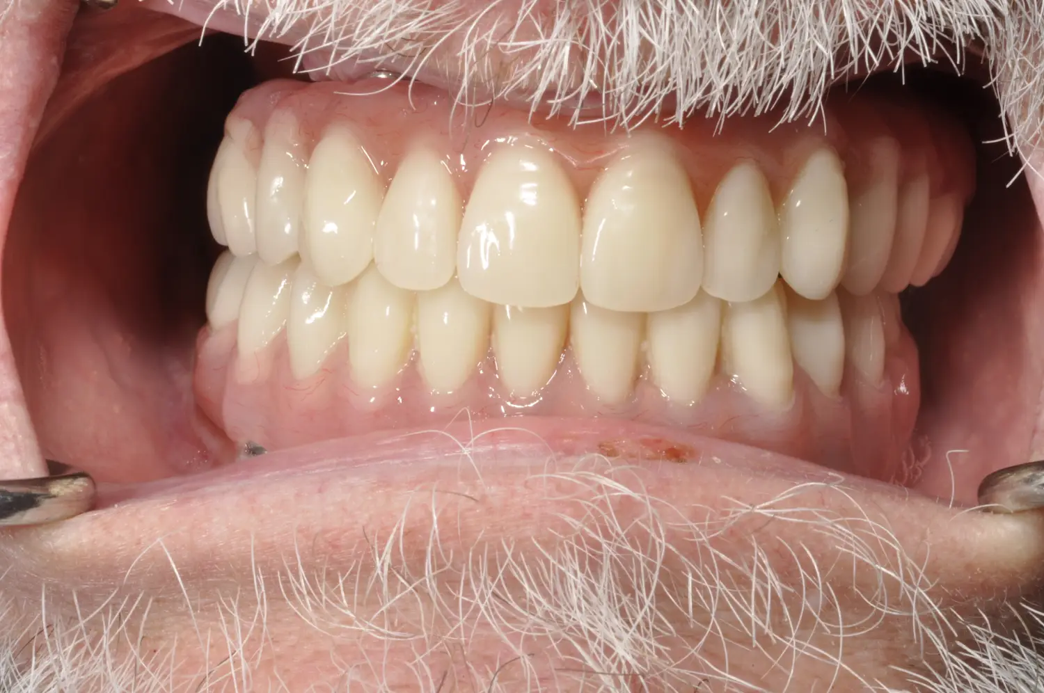 Dentist in Vienna | Vienna Smiles