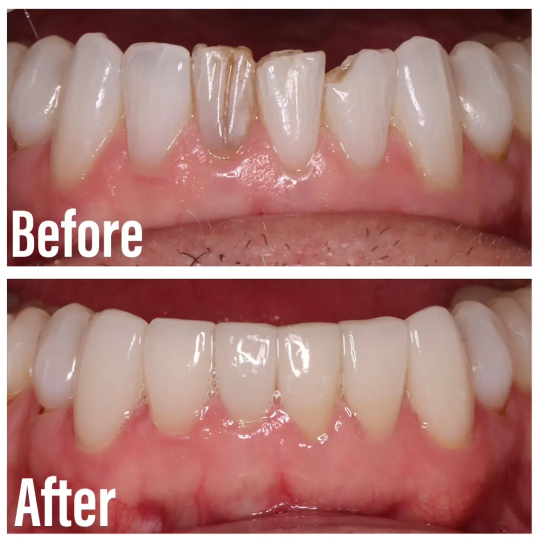 Dentist in Hot Springs, AR | Smile Hot Springs