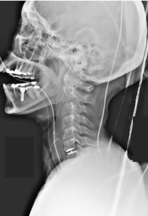 Back & Neck Pain Phoenix, Arizona - Dr. Andrew Chung | Services | Dr ...