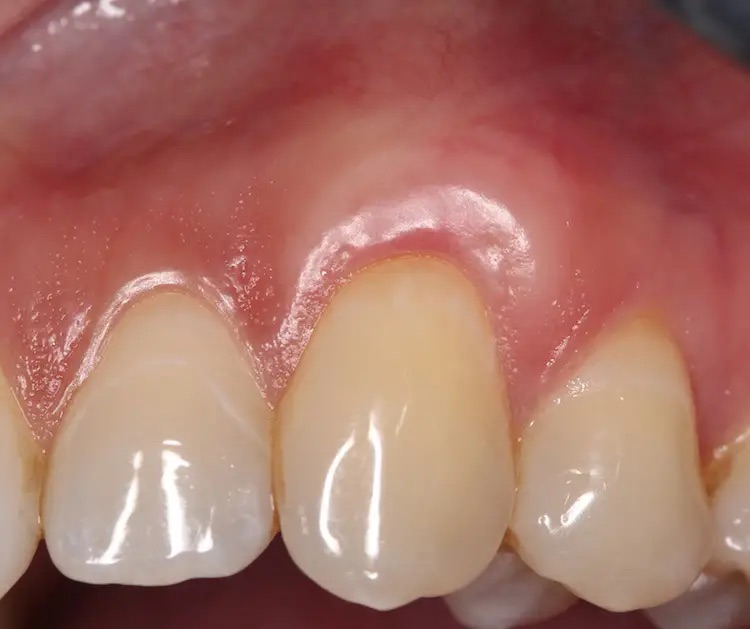 Before & Afters | Dental Specialists of North Florida