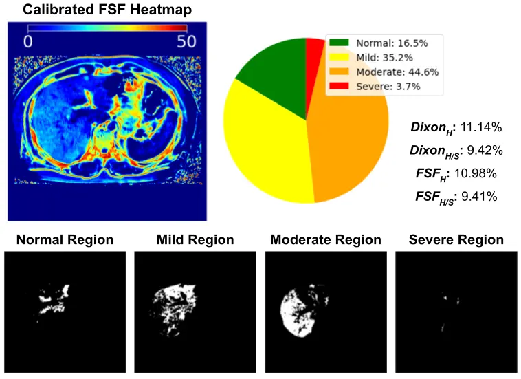 Deep Learning Based 3D Whole Liver and Spleen Segmentation for ...