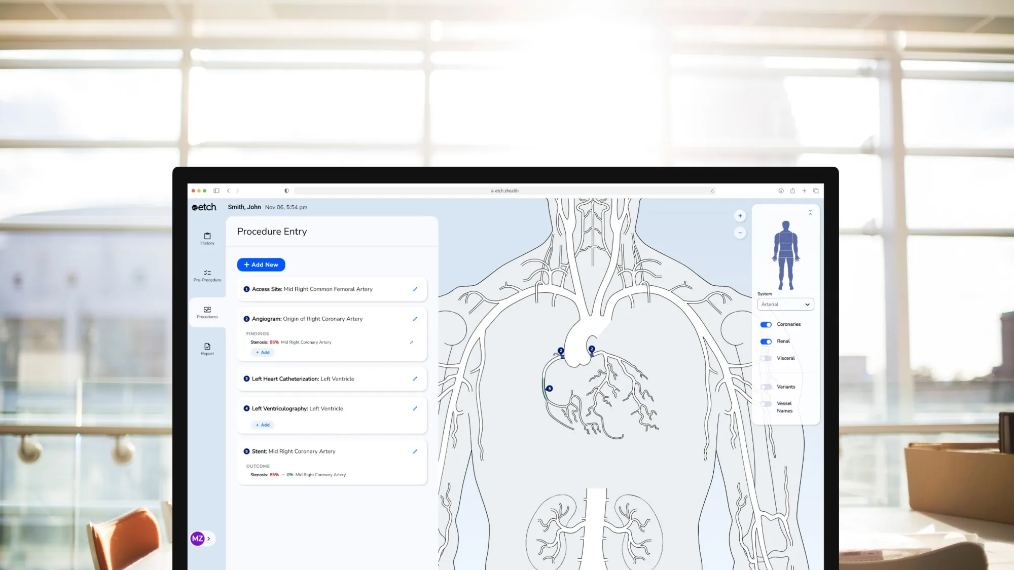 Etch by ZHealth Documentation