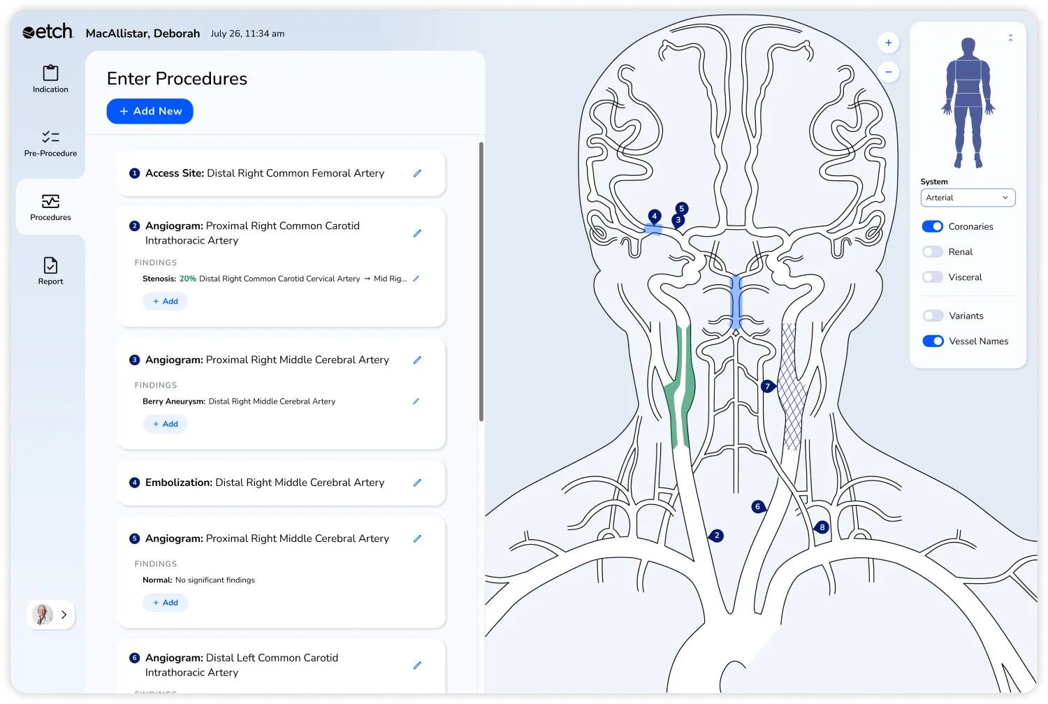 Etch-Guided Documentation