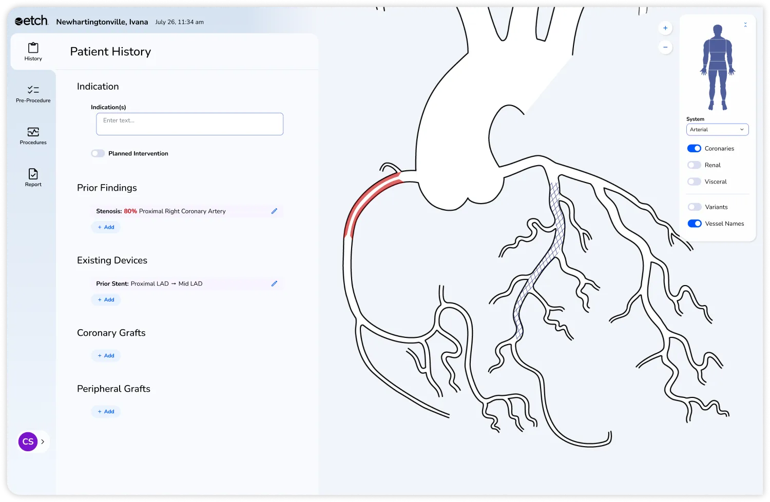 Etch-Guided Documentation